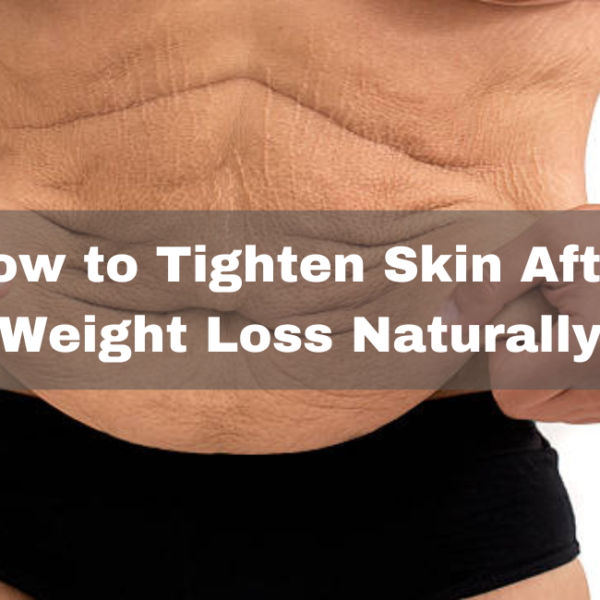 8 Ways To Get Rid Of Fat Lines On Your Stomach